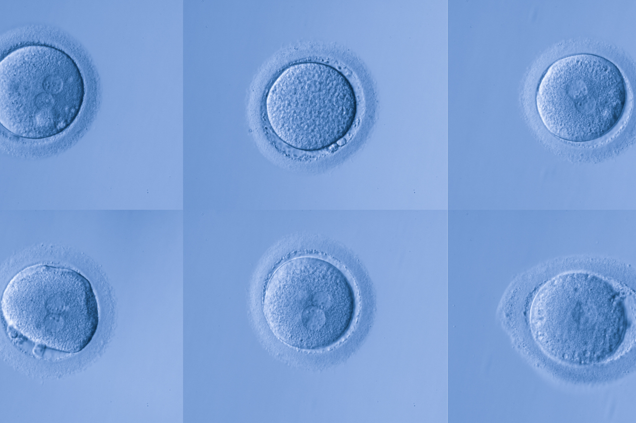 Human Female Egg Microscope